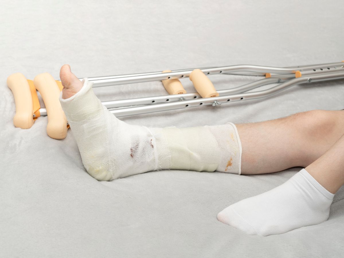 Fracture Recovery - Dr. Elham