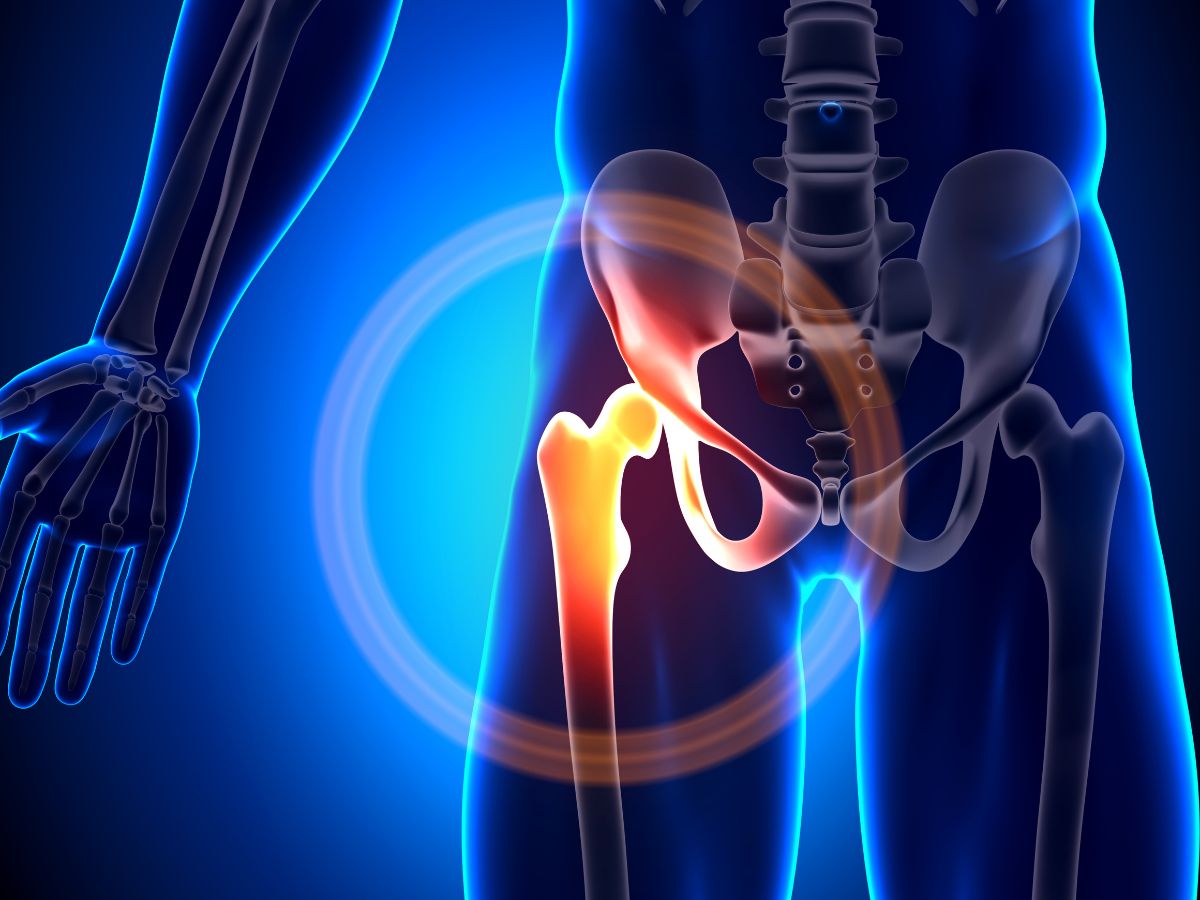 Hip & Pelvis Alignment – Primary Health Clinic